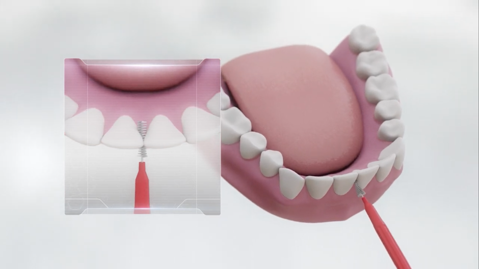 Piksters® Dental NZ - The Best Interdental Brushes – Piksters NZ
